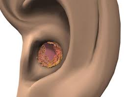 What's earwax, how does it build up, and how can we clean it away when ...