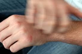 Why does it feel good to scratch an itch? - Fun Kids - the UK's ...